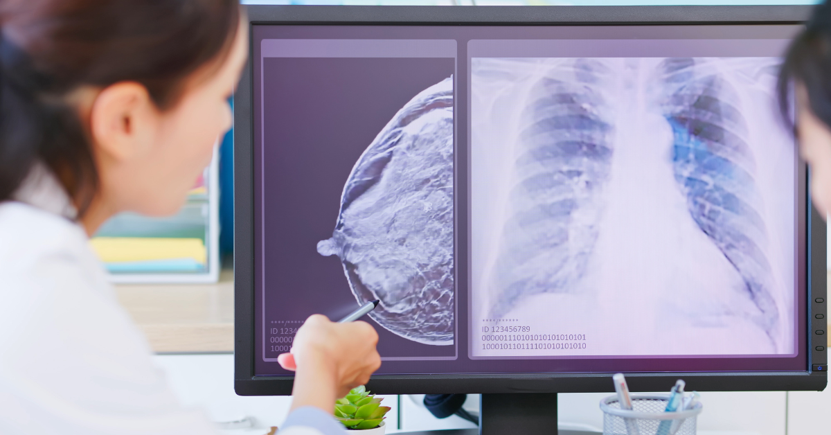 Princess CSTN - Fondation Bergonié